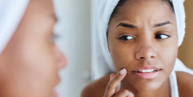 Is your skin stressed? Here’s what you need to know. – REALHER